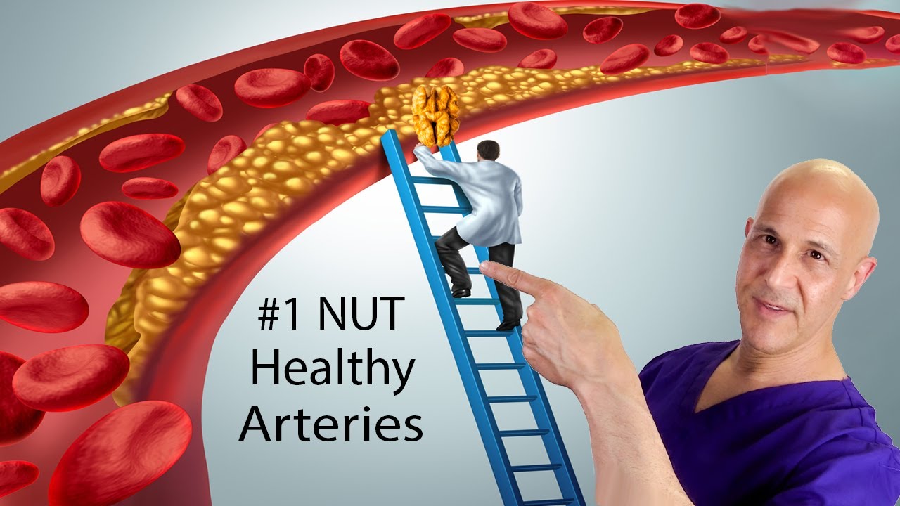 #1 NUT...Clean Arteries, Lower Blood Pressure, Prevent Heart Attack ...