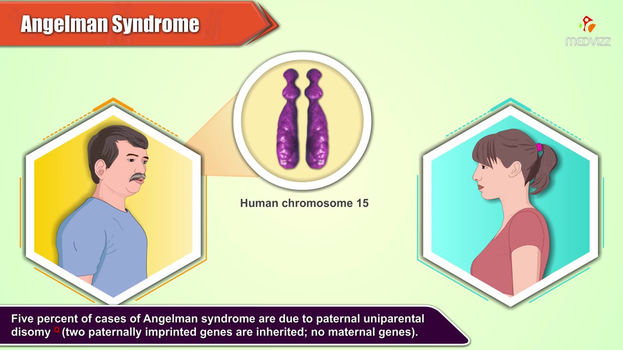Angelman Syndrome : Pathology and Genetics - YouTube