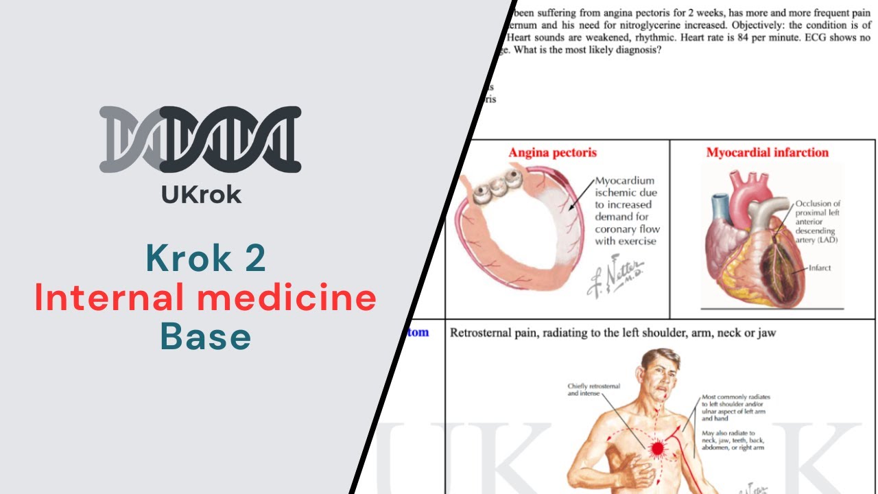 Krok 2 Internal Medicine 2023 Base - YouTube