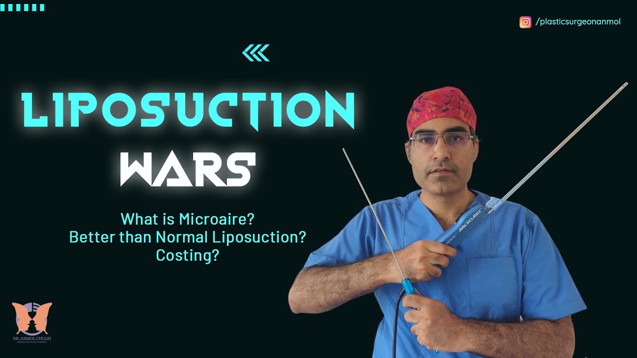 💥BANG💥💥| Microaire vs Power Assisted Liposuction Which is the BEST for ...