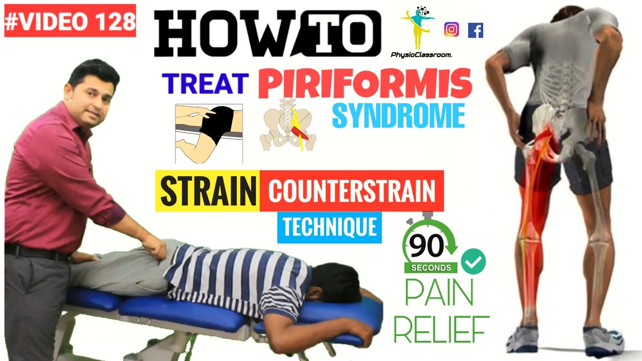 STRAIN COUNTERSTRAIN TECHNIQUE TO TREAT PIRIFORMIS SYNDROME : PAIN ...