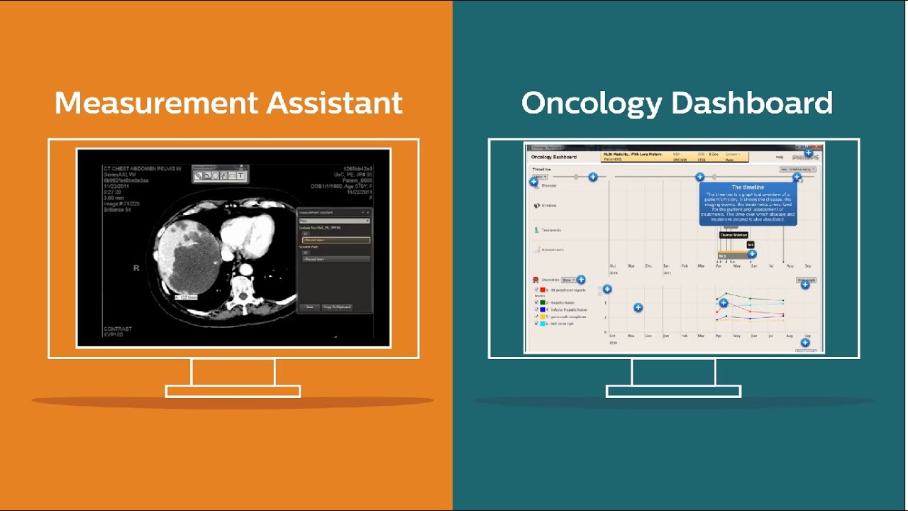 Clinical Context Applications: Oncology Dashboard & Measurement ...