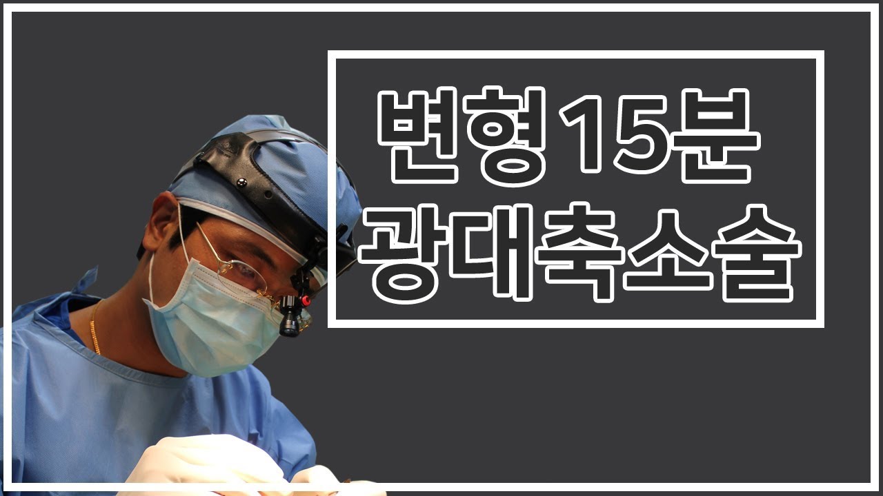 변형15분광대축소술 패키지 feat.전후사진(reduction malarplasty/cheekbone reduction ...