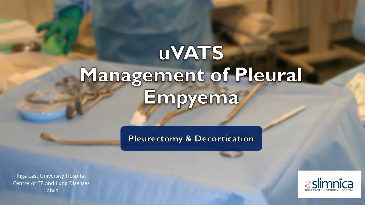 uVATS Pleurectomy & Decortication for Empyema - YouTube