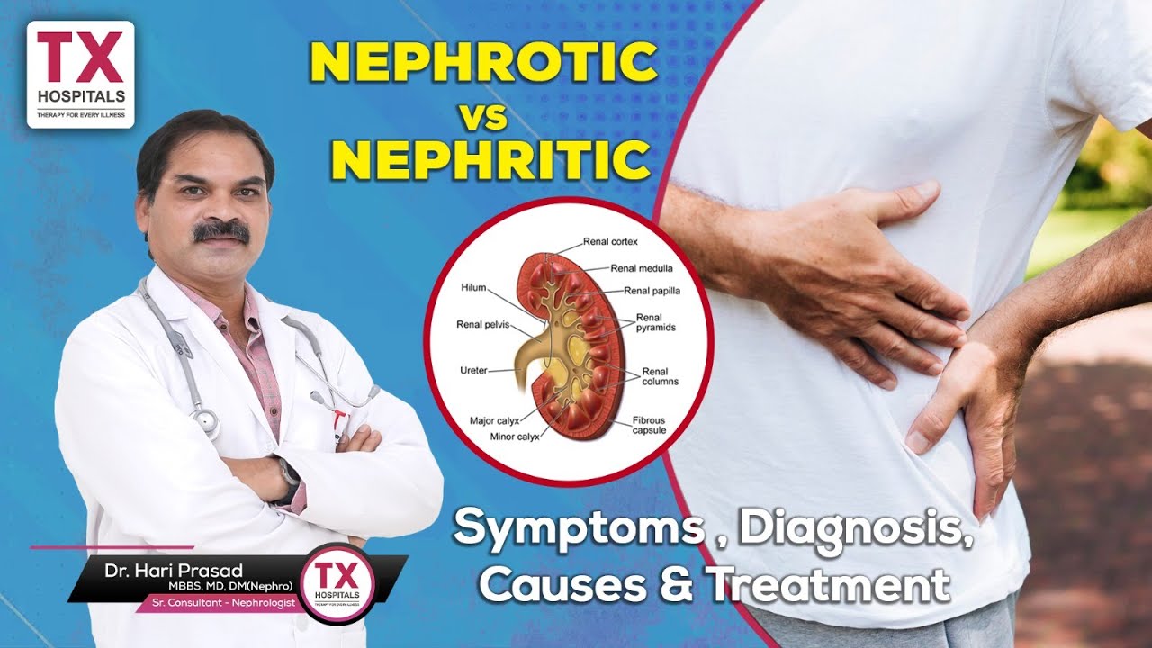 Understanding the Differences: Nephrotic vs. Nephritic Syndrome || Dr ...