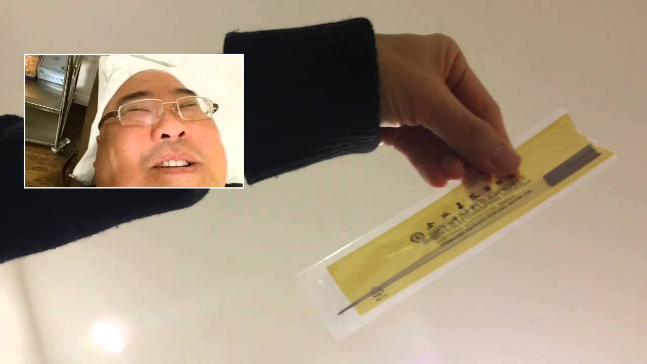 The 8 Inch Needle Used In My Acupuncture Session - YouTube