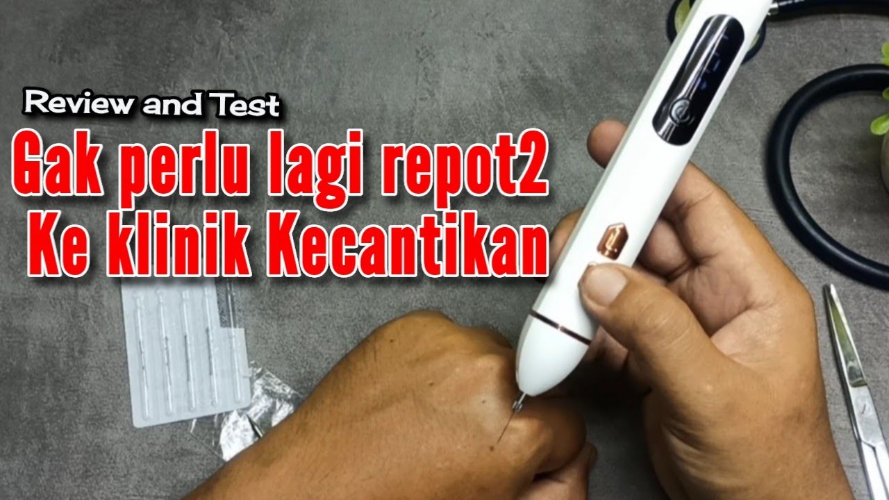 Alat Cauter Penghilang Flek di wajah,Kutil dan Tahi lalat. - YouTube