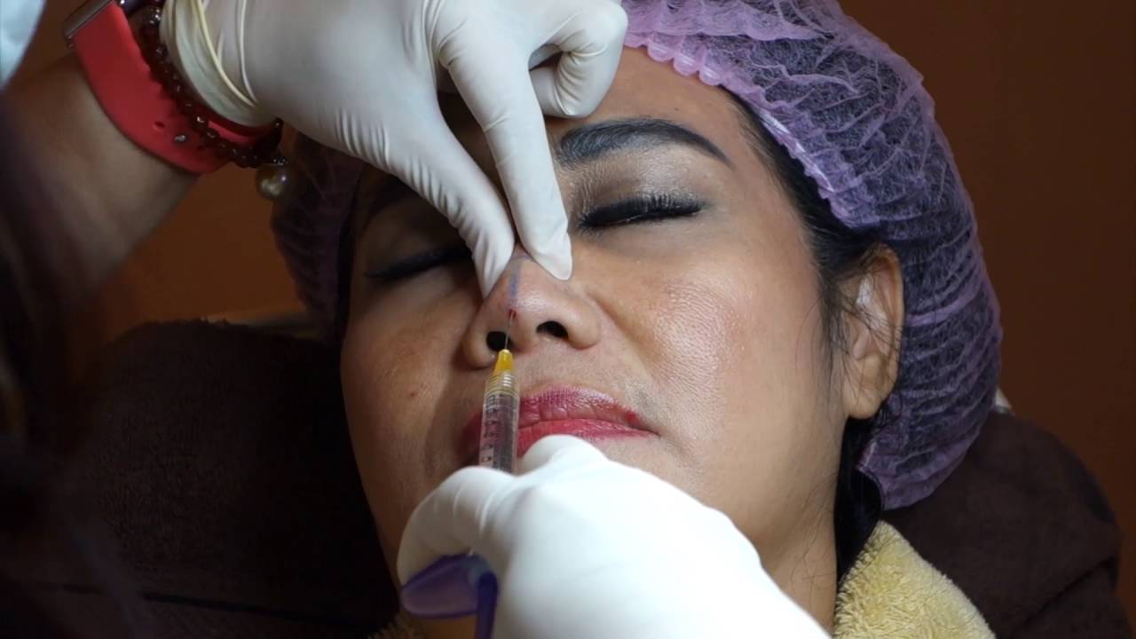 Madeline Beauty Center NOSE FILLER & THREADS - YouTube
