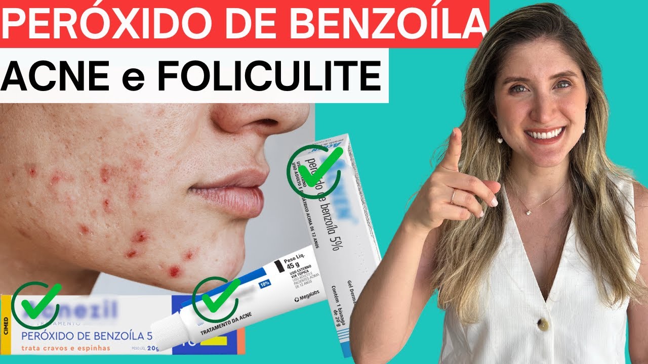 Peróxido de Benzoíla: Acnezil, Clindoxyl, Acnen, Dermotivin Benzac ...