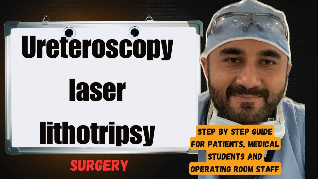 What to Expect for Ureteroscopy with Laser Lithotripsy Surgery 😳(Step ...
