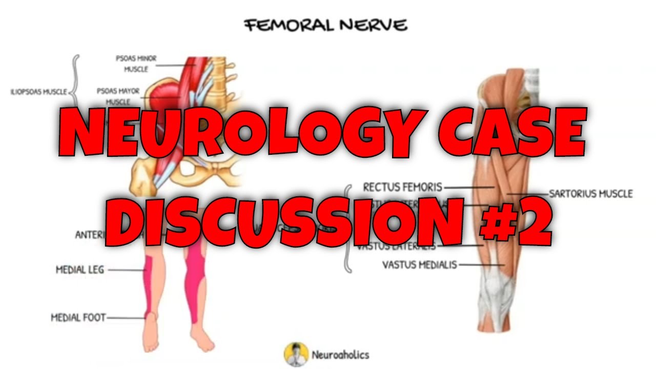 How does referred pain in low back happen? Referred low back pain sucks ...