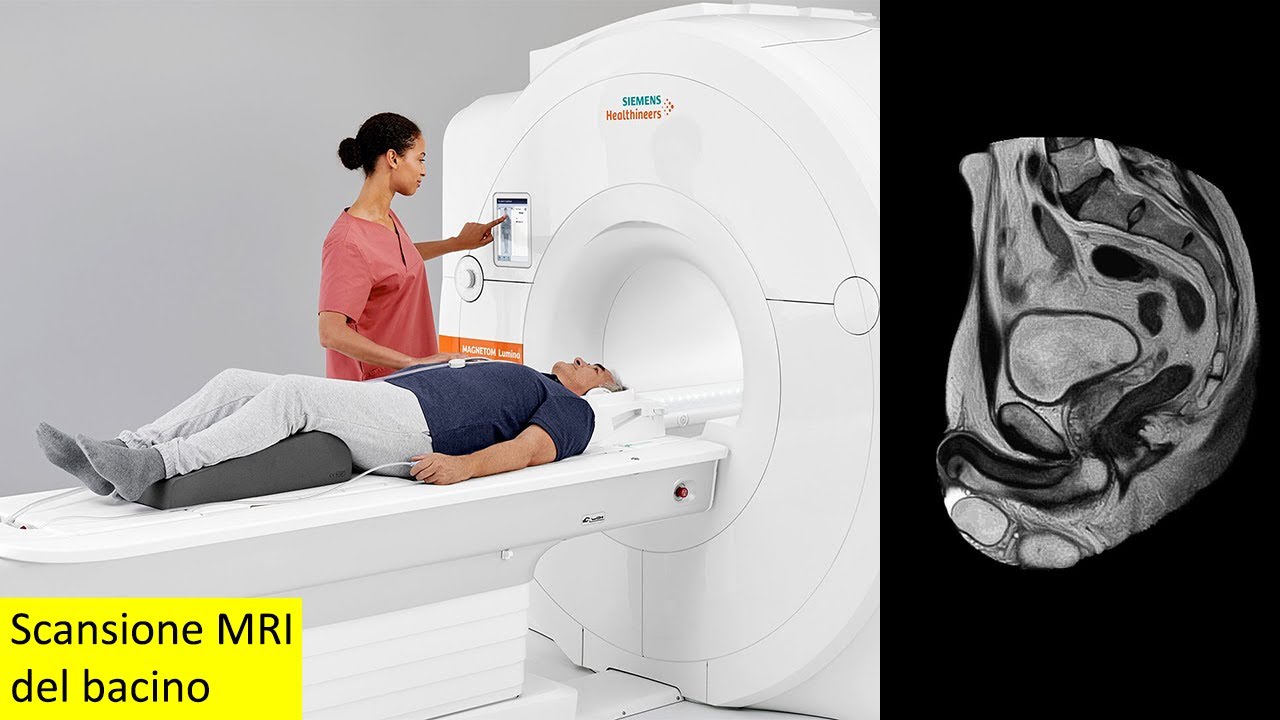 Exploración por resonancia magnética de la pelvis - YouTube