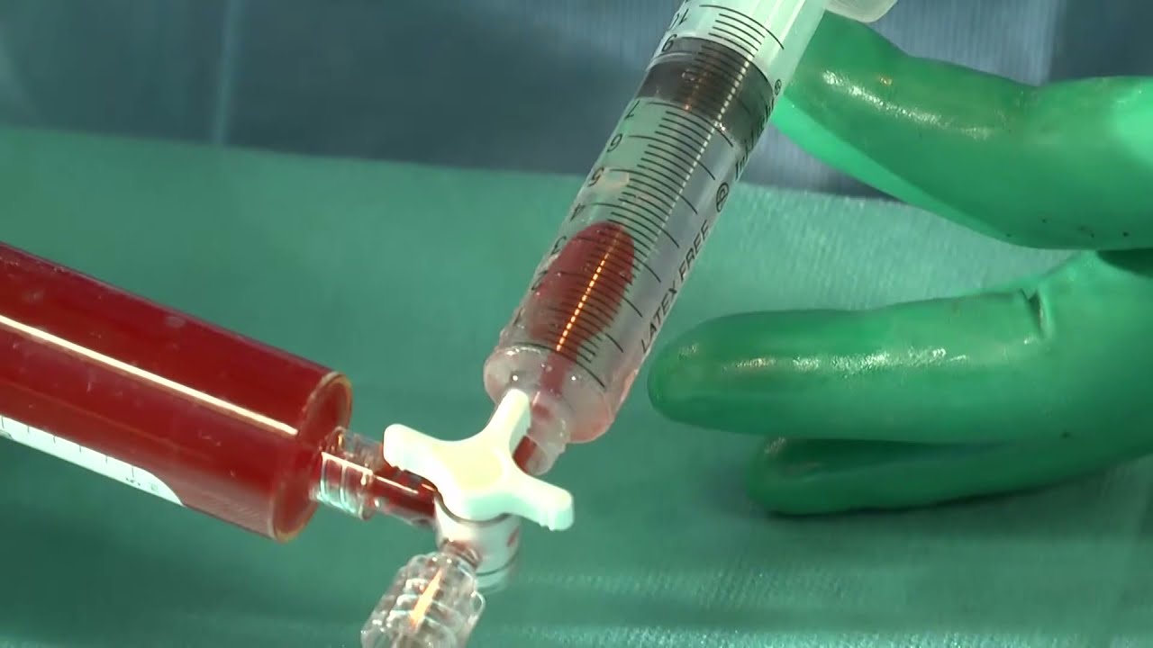 Embozene Tandem 40 micron particles: drug load and delivery to a ...