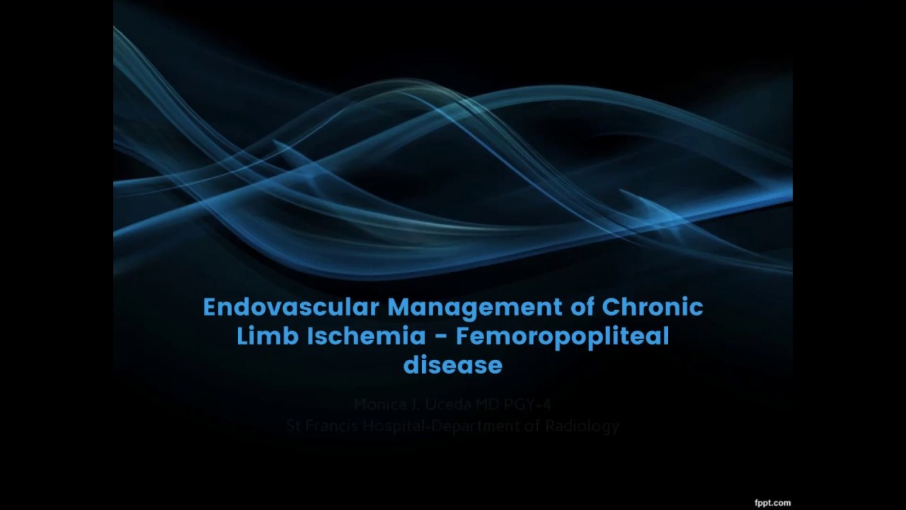 SIR-RFS Webinar (08/03/2017): SIR RFS Journal Club - YouTube