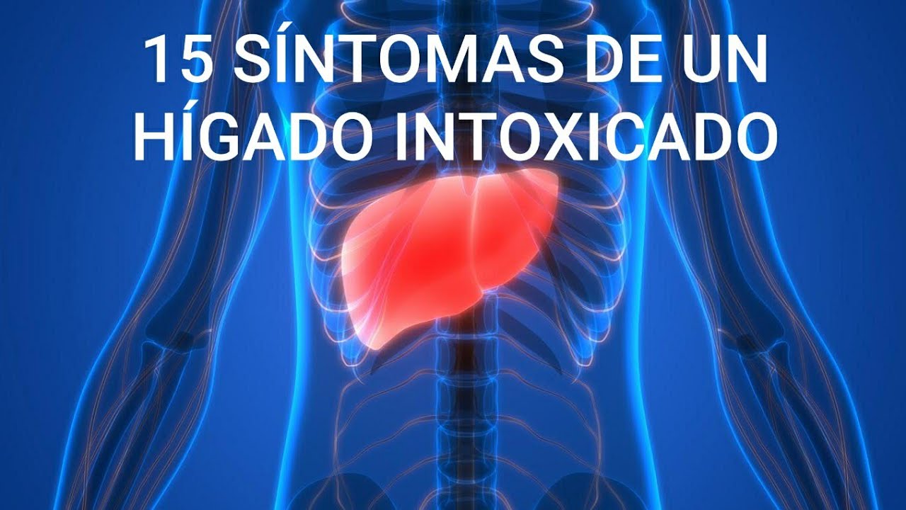 15 SINTOMAS DE UN HÍGADO INTOXICADO - YouTube