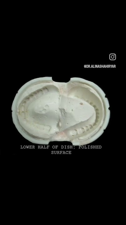 HOW TO COPY/DUPLICATE A DENTURE WITH SOAP DISH TECHNIQUE - YouTube