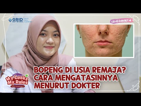 CARA MENGHILANGKAN BOPENG BEKAS JERAWAT MENURUT DOKTER || BOPENG DI KULIT BISA KEMBALI MULUS!