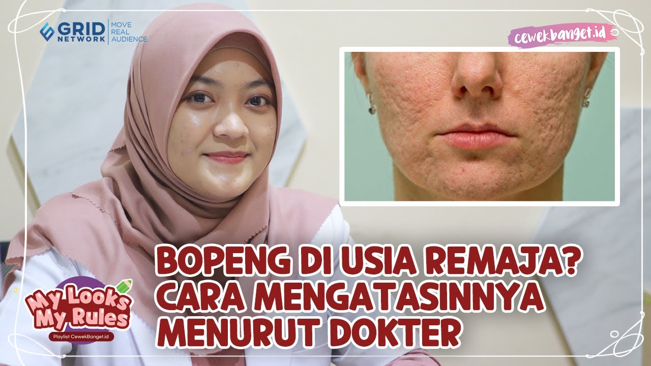 CARA MENGHILANGKAN BOPENG BEKAS JERAWAT MENURUT DOKTER || BOPENG DI ...