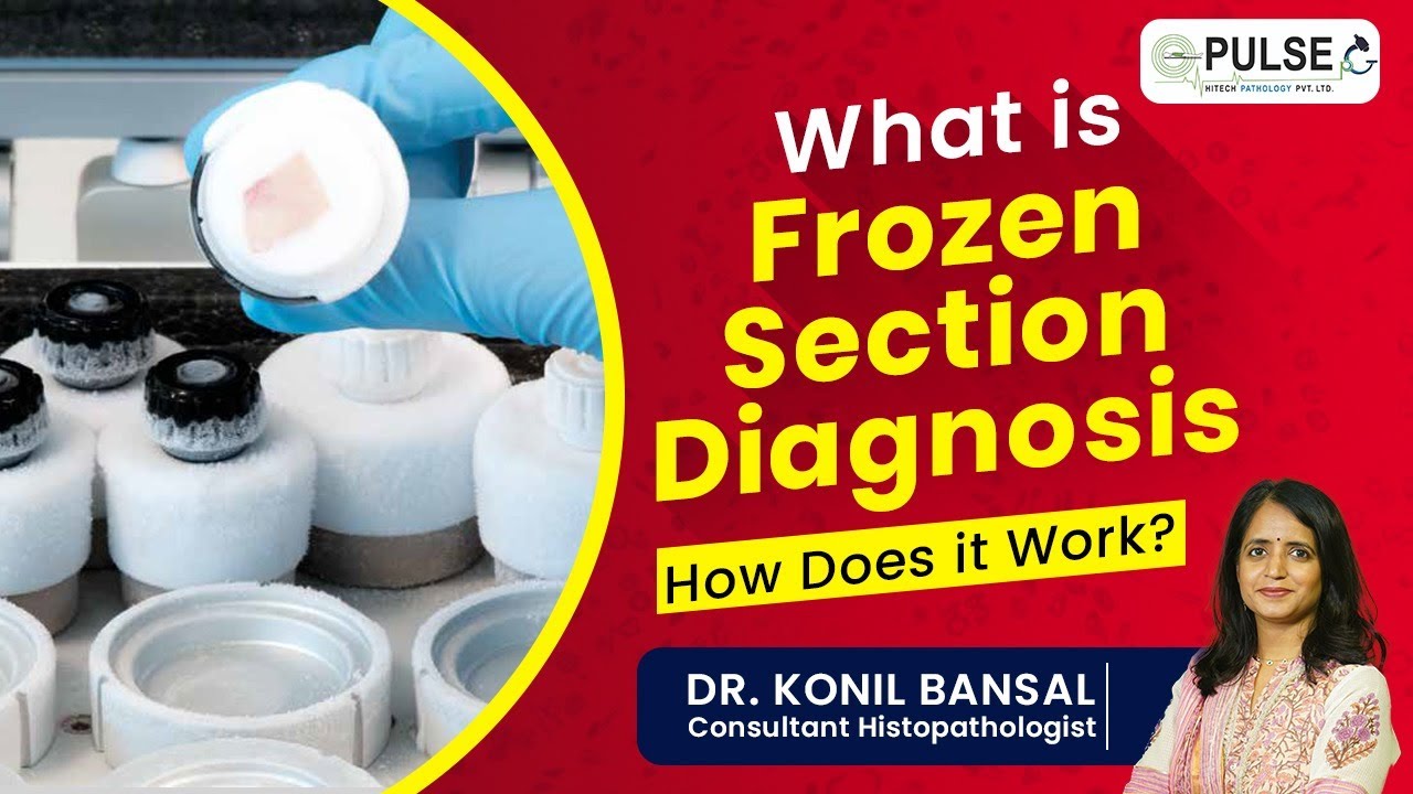 What is Frozen Section Diagnosis? | Uses, Procedures, and Margin States ...