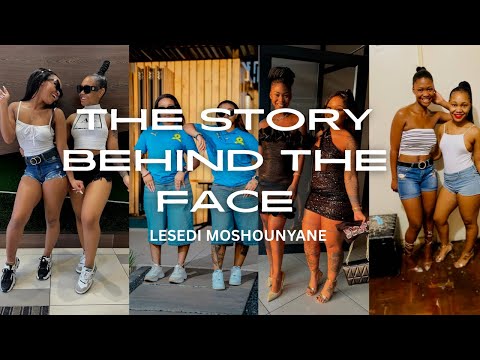 THE STORY BEHIND THE FACE | How I made it this far & the challenges