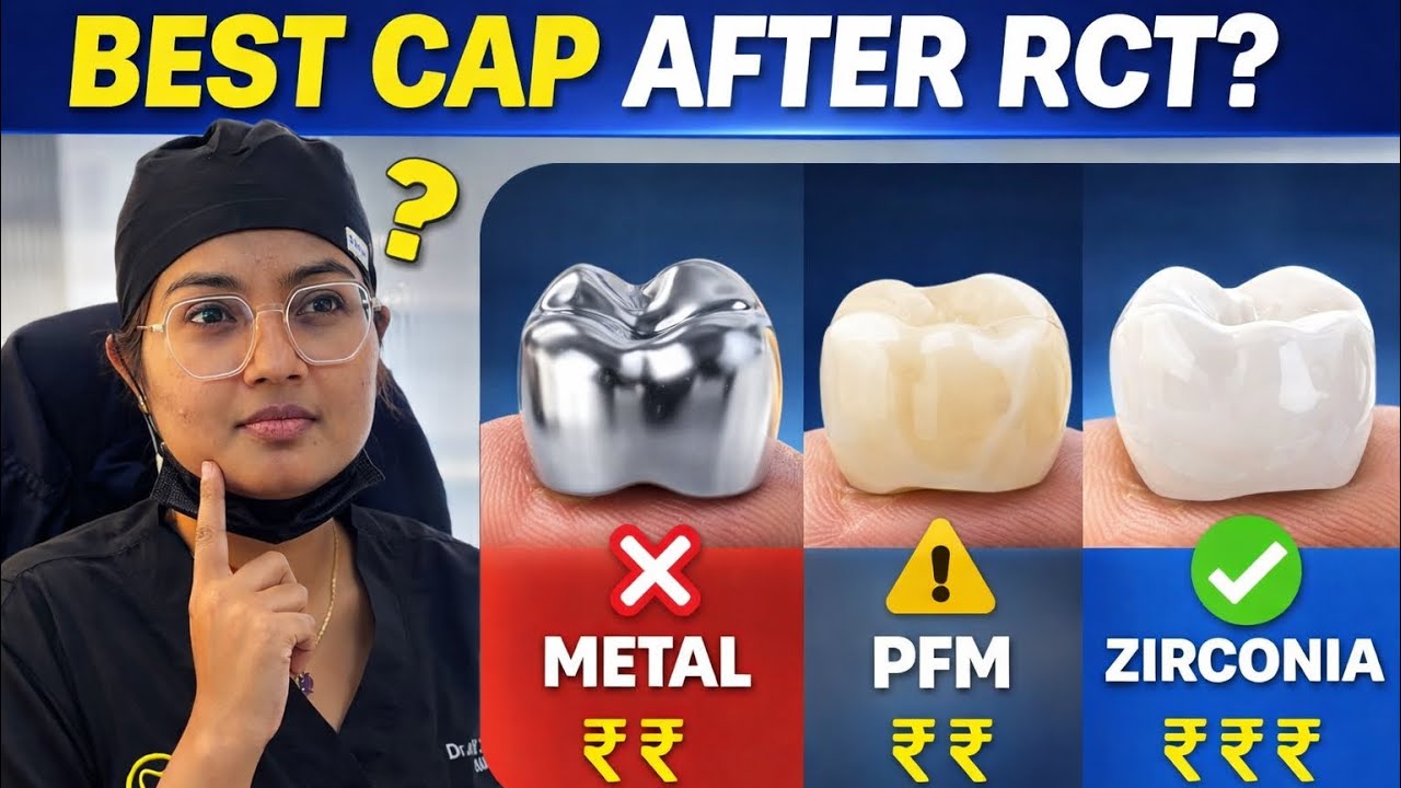 Best Cap After Root Canal? | Metal vs PFM vs Zirconia Crowns Explained ...