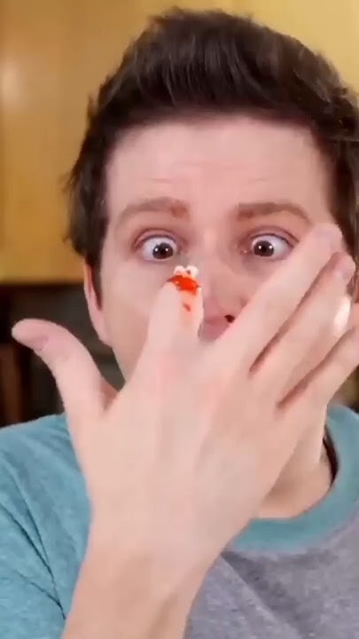 "If you accidentally cut off your finger… DON’T panic! 🩸😨" - YouTube