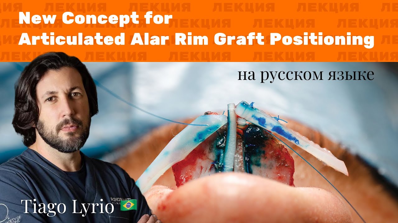 Лекция: New Concept for Articulated Alar Rim Graft Positioning (на ...