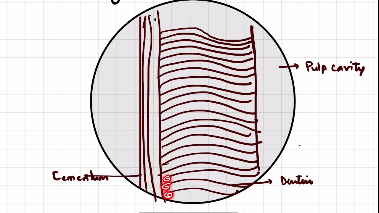 Dentin - Incremental lines, Tomes granular layer and Interglobular ...