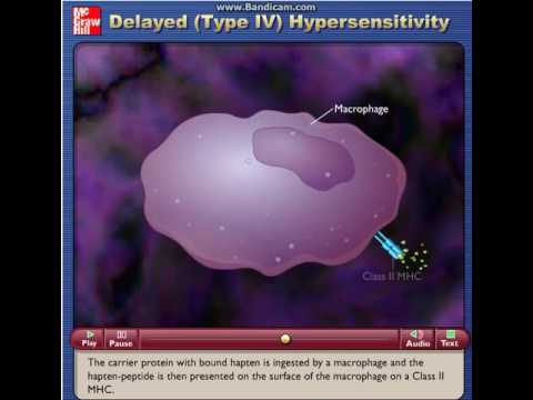 Delayed - Type IV Hypersensitivity - YouTube