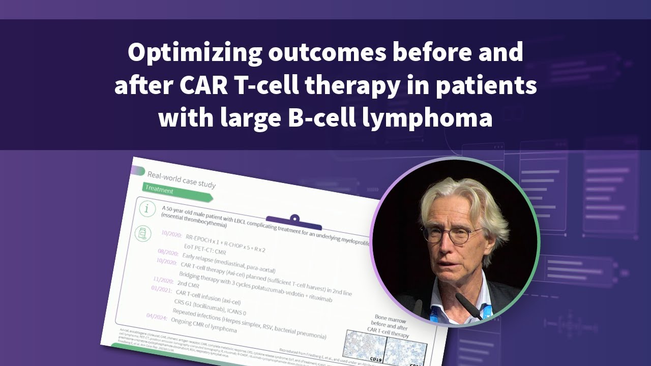 Optimizing outcomes before and after CAR T-cell therapy in patients ...