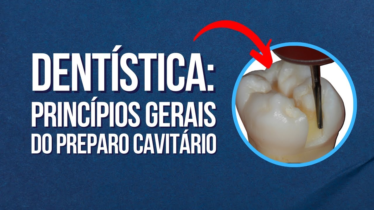 Princípios gerais do preparo cavitário - YouTube