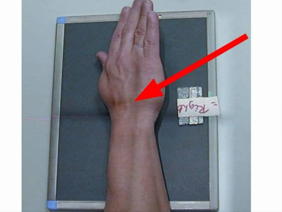 Wrist PA, Oblique And Lateral, 55% OFF