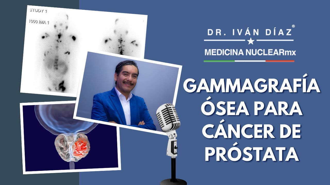 Gammagrafía ósea para el cáncer de próstata. - YouTube