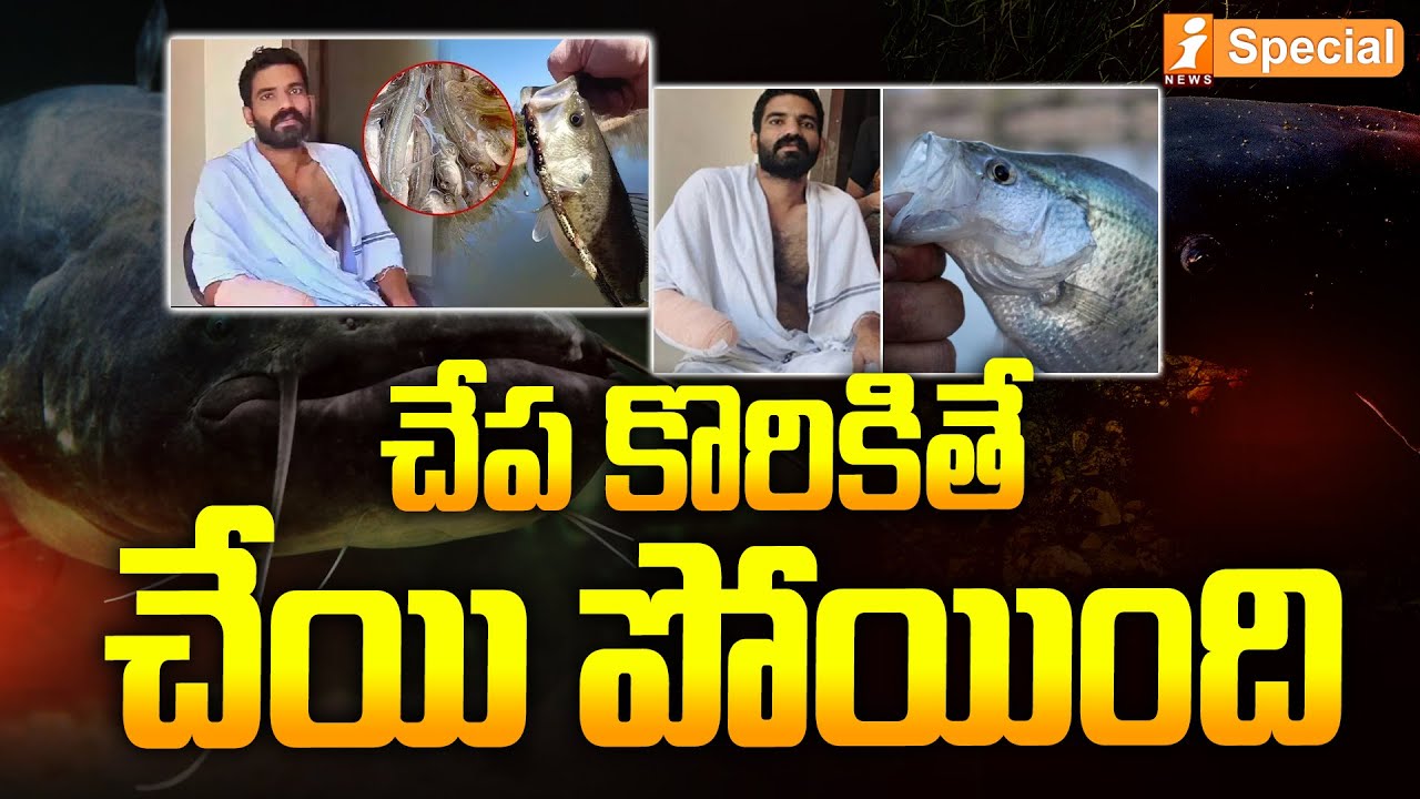 చేప కొరికితే చేయి పోయింది | Kerala Man's Hand Amputated After Fish Bite ...