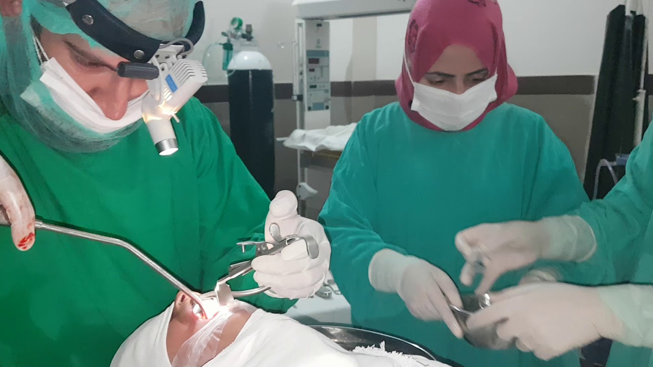 Adenoidectomy and tonsillectomy - YouTube