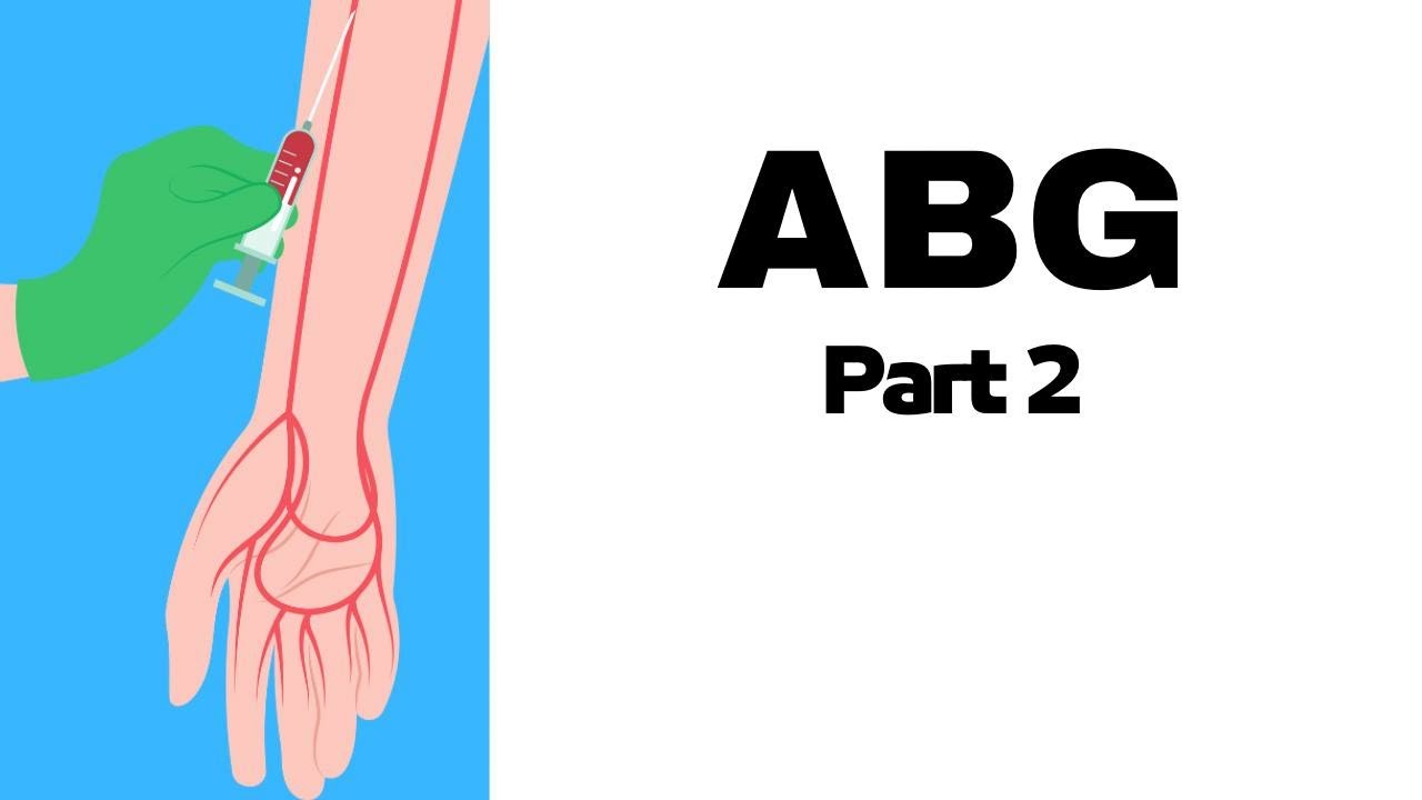 ABG | ICU | part 2 - YouTube