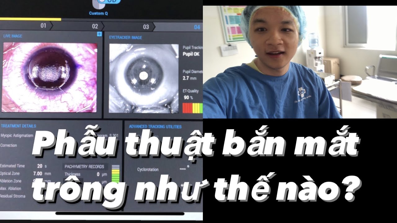 Quá trình Phẫu thuật bắn mắt của mình | Kitto Katto - YouTube