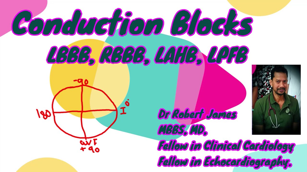 Conduction Blocks LBB RBBB LAHB LPFB by Dr Robert James MD, Fellow in ...