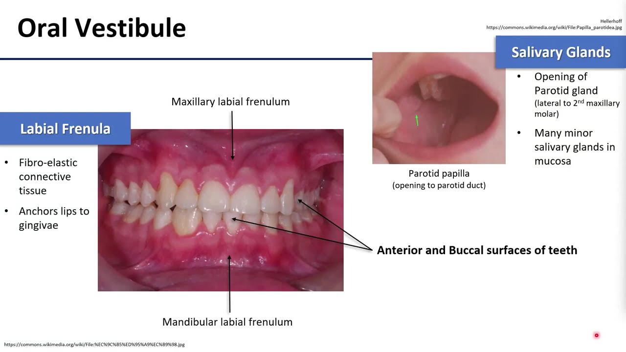 Oral Cavity Vestibule Endoscopic Study Of The Oral And Pharyngeal
