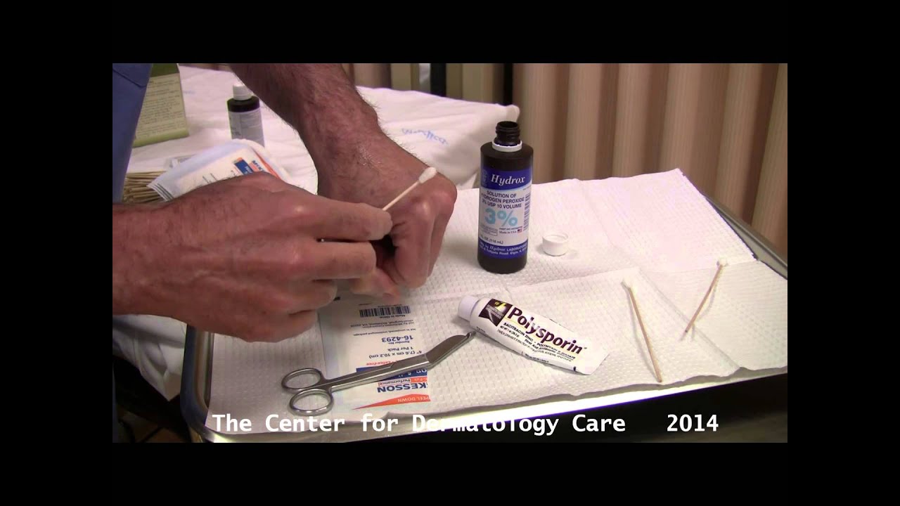 Mohs Care Instructions for Patients - YouTube