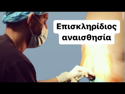 Πως γίνεται η Επισκληρίδιος αναισθησία...στην πράξη! #επισκληριδιος # ...