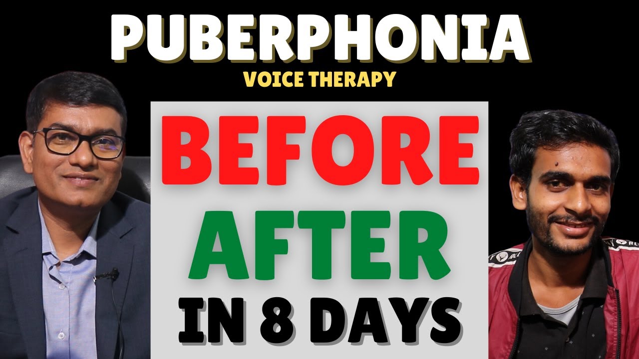 Unbelievable Voice Transformation: Before-After Puberphonia Therapy in ...