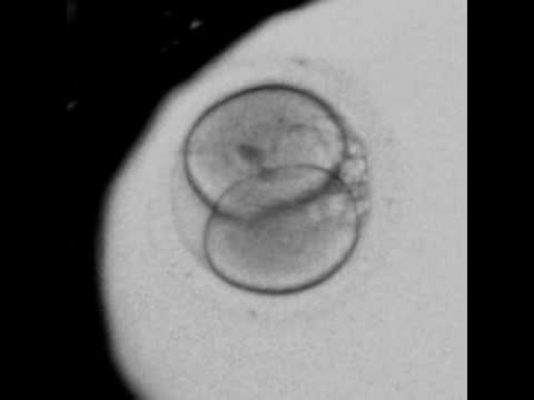 Abnormal 2nd cleavage of human embryo - aneuploidy confirmed after PGS ...