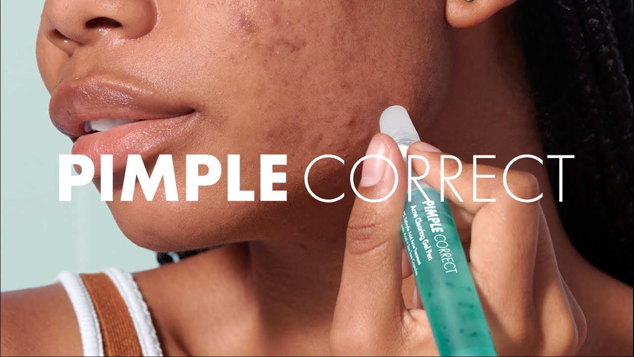 Hero’s NEWEST product: Pimple Correct - YouTube