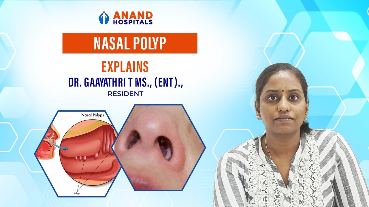 Understanding Nasal Polyps Causes Symptoms And Treatment Dr