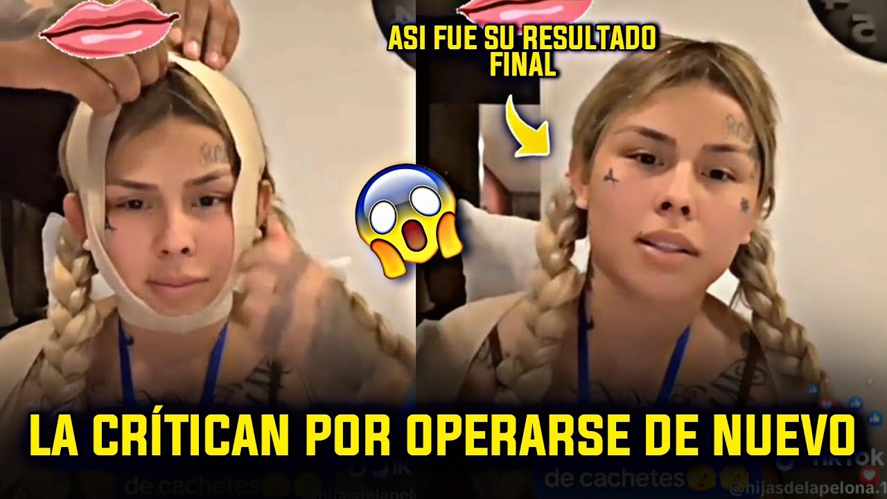 MONA MUESTRA EL RESULTADO FINAL DE SU OPERACIÓN DE CACHETES - YouTube