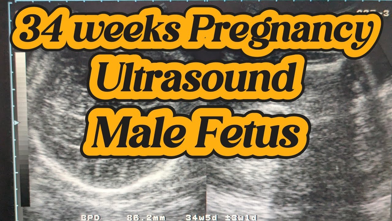 34 Weeks Ultrasound Gender Reveal | A Deep Dive into Obs Ultrasound | The Art of obs Imaging ...