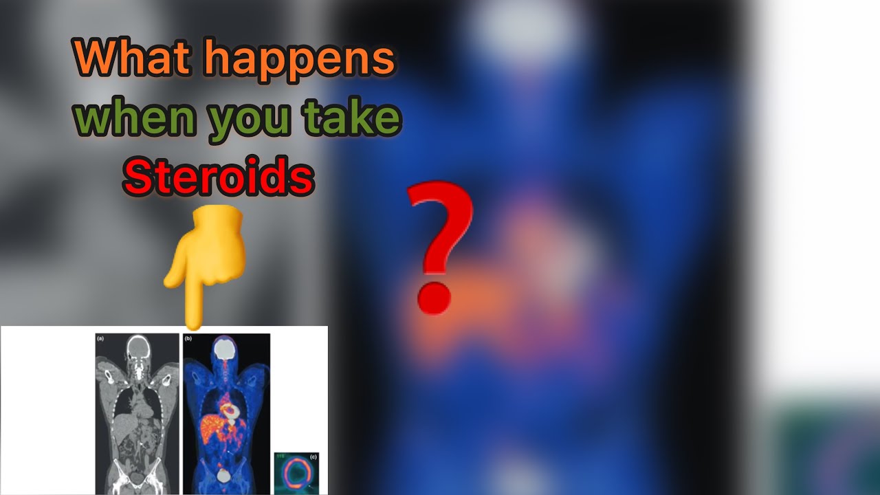 What happens when you take STEROIDS ? 👉Are they Safe to build Abs ...