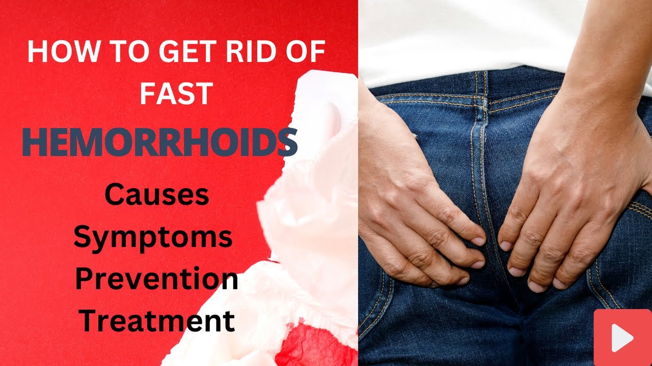 How to Get Rid of Hemorrhoids Fast : Causes, symptoms, prevention ...