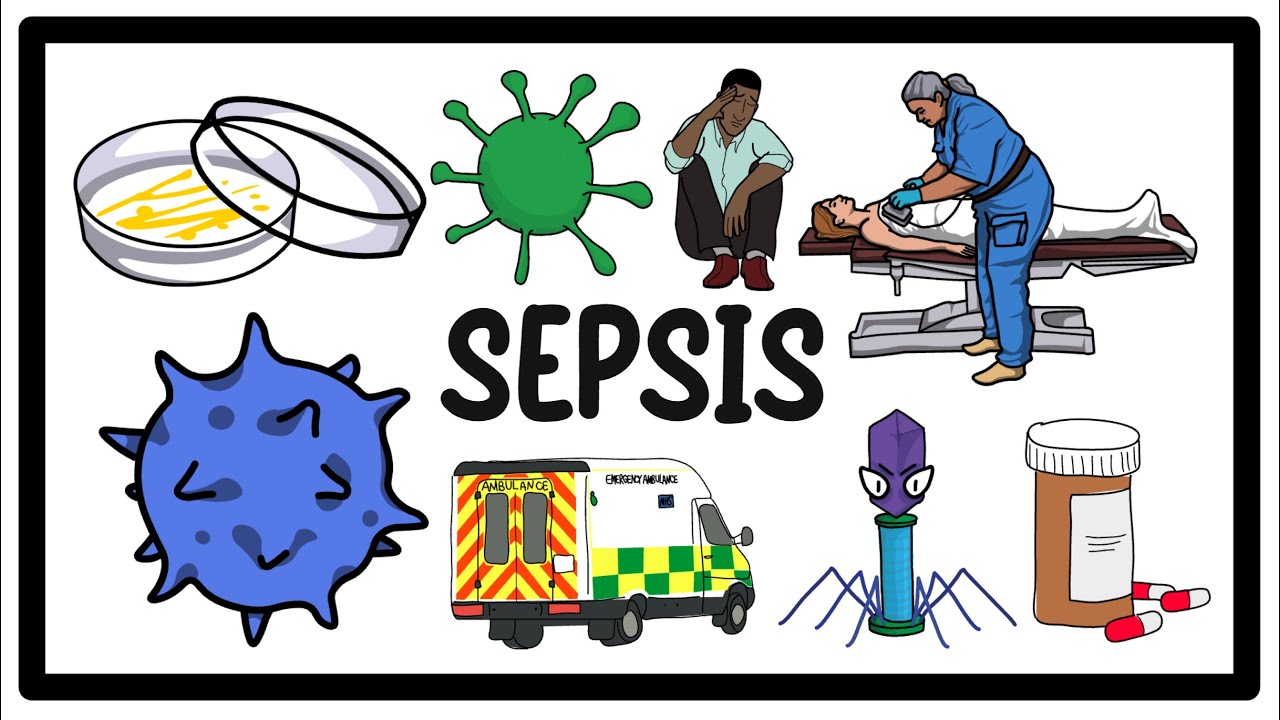 Sepsis Infection & Septic Shock: The Ultimate Guide to Symptoms and ...